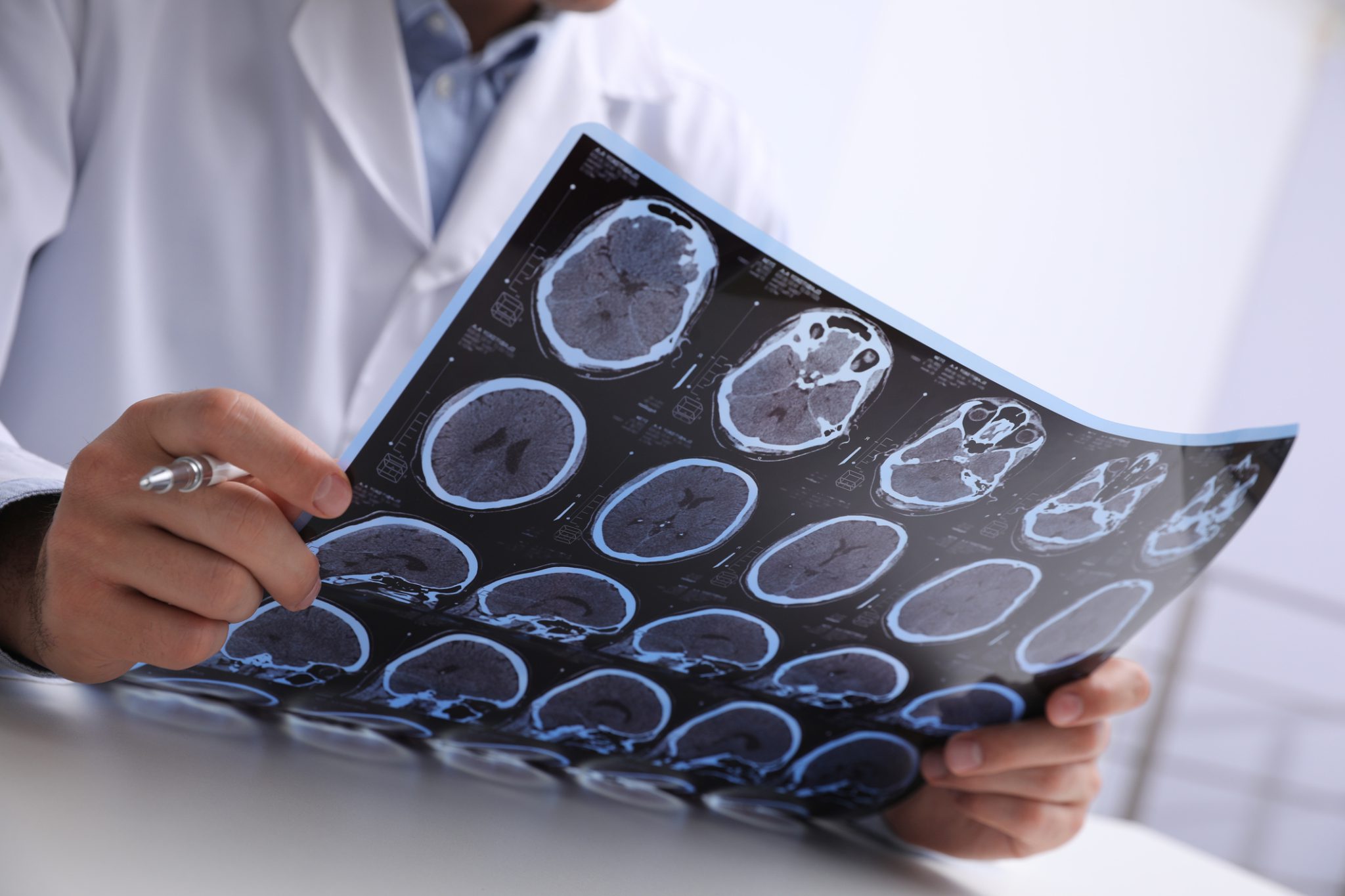 New Study Uncovers Key Culprit Behind Pediatric Brain Cancer Metastasis ...