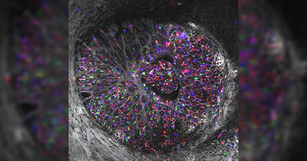 Seeing the Unseen Eye: Astrocytes at the Bridge to the Brain - UPMC ...