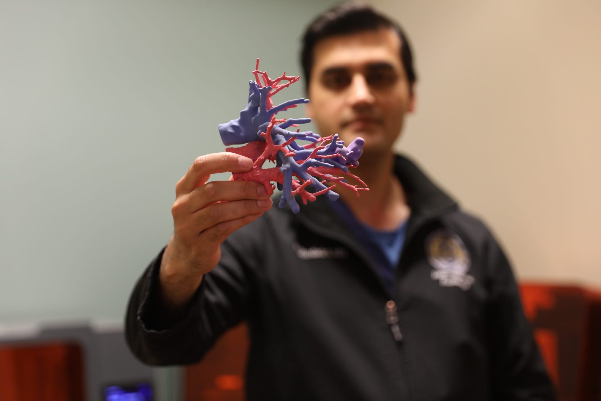 Models created by UPMC 3D Printing Program Improve Patient-Centered Care - UPMC & Pitt Health ...