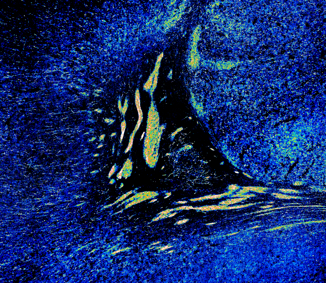 Integrating Research and Clinical Care to Uncover Secrets of Brain ...