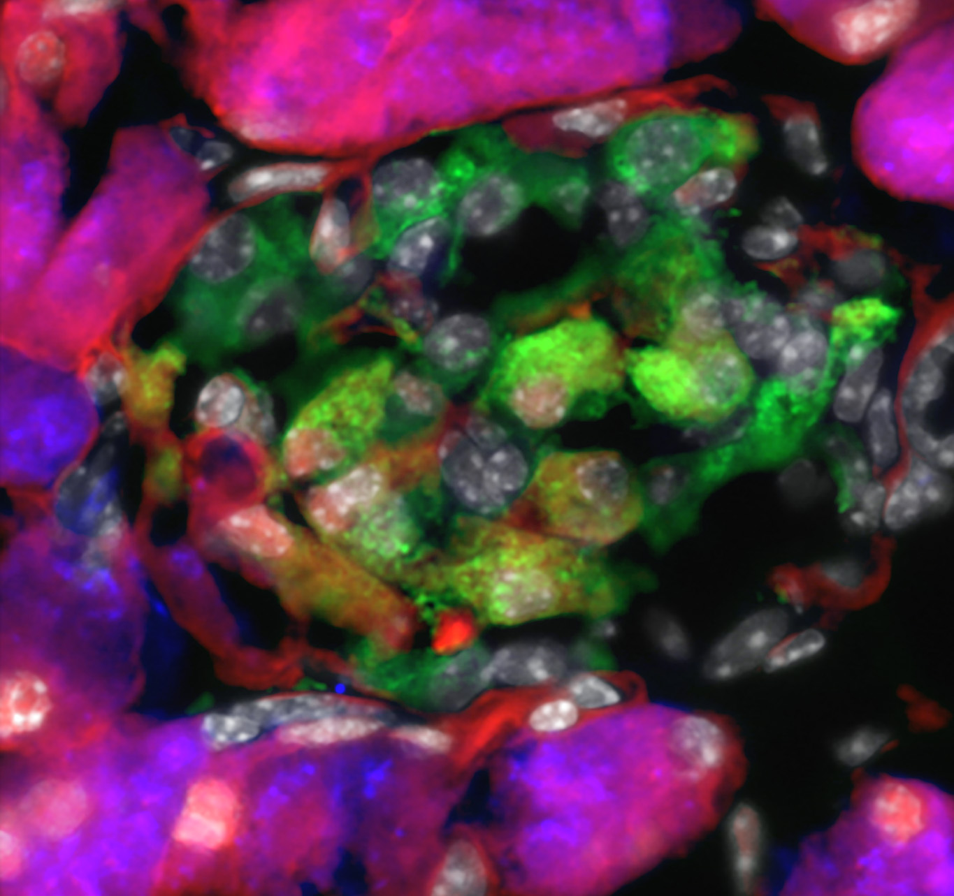 Repurposed Cancer Drug Could Treat Diabetes by Nudging Pancreatic ...